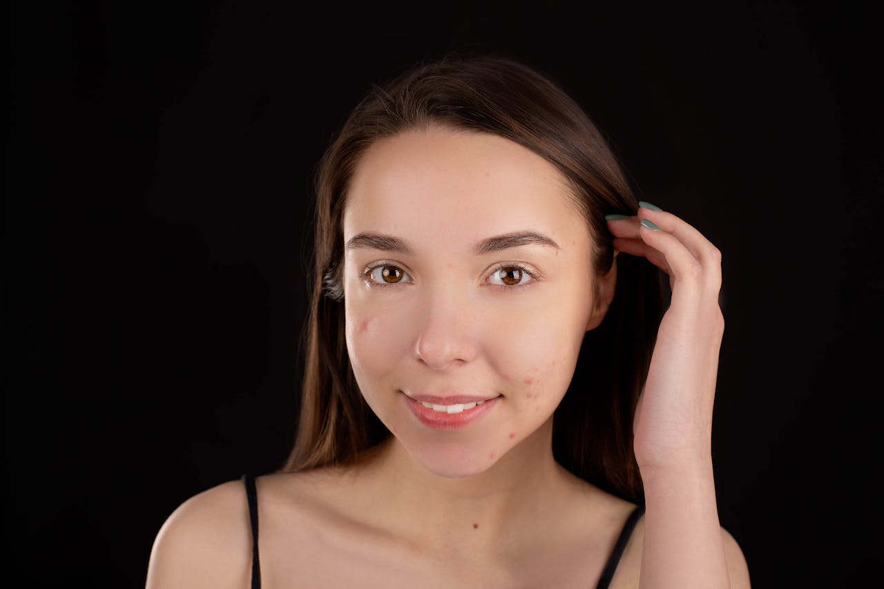 Clear Skin Starts Here: Best Acne Face Wash Guide by TrulyKomal – Truly ...